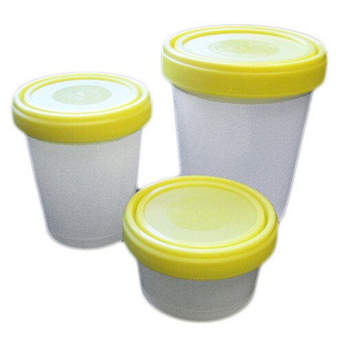 Globe Scientific 6542 Graduated Histology Specimen Container with Yellow Sc